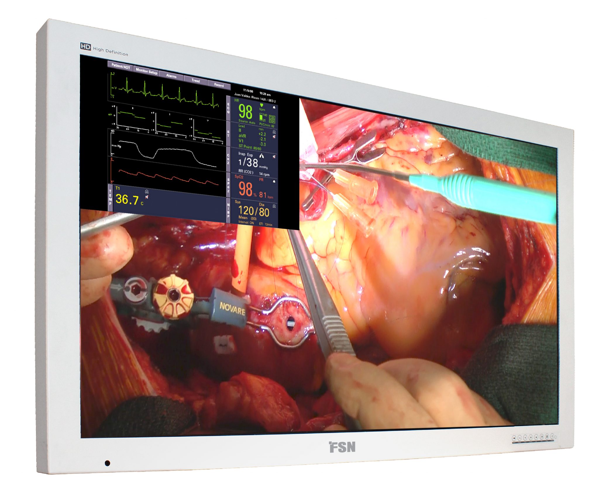 Surgical Displays – Keckler Medical
